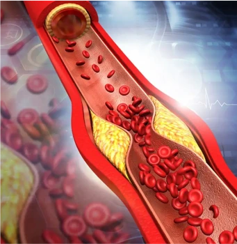 Innovative Vascular Care | Across Virginia & Maryland